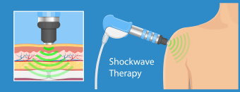 Shockwave Therapy